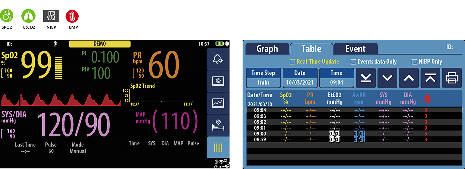 XH-60 Series Capnograph Monitor