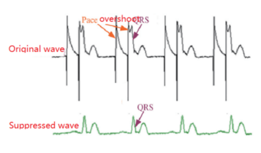 XH-60 Series Capnograph Monitor