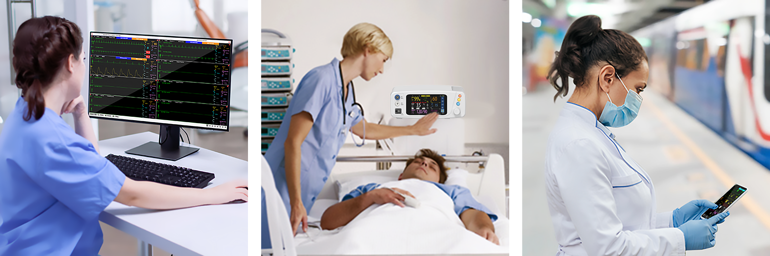 XH-60 Series Capnograph Monitor